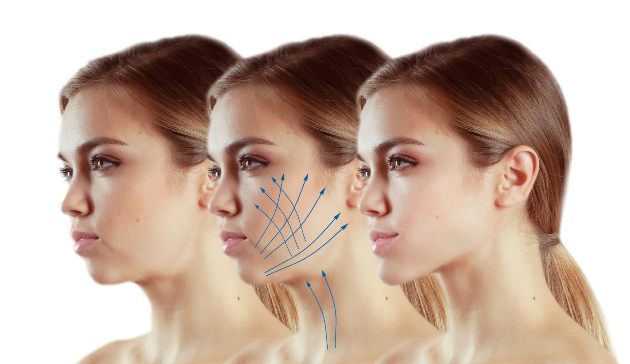 8-point Face LiftTreatment - Prime Beauty & Aesthetics - Manchester