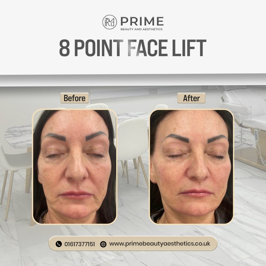 Price List - Prime Beauty & Aesthetics - Manchester